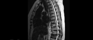 MRT Untersuchungsregion BWS | Praxis für Radiologische Diagnostik Hanau