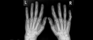 Röntgen Hand | Praxis für Radiologische Diagnostik Hanau